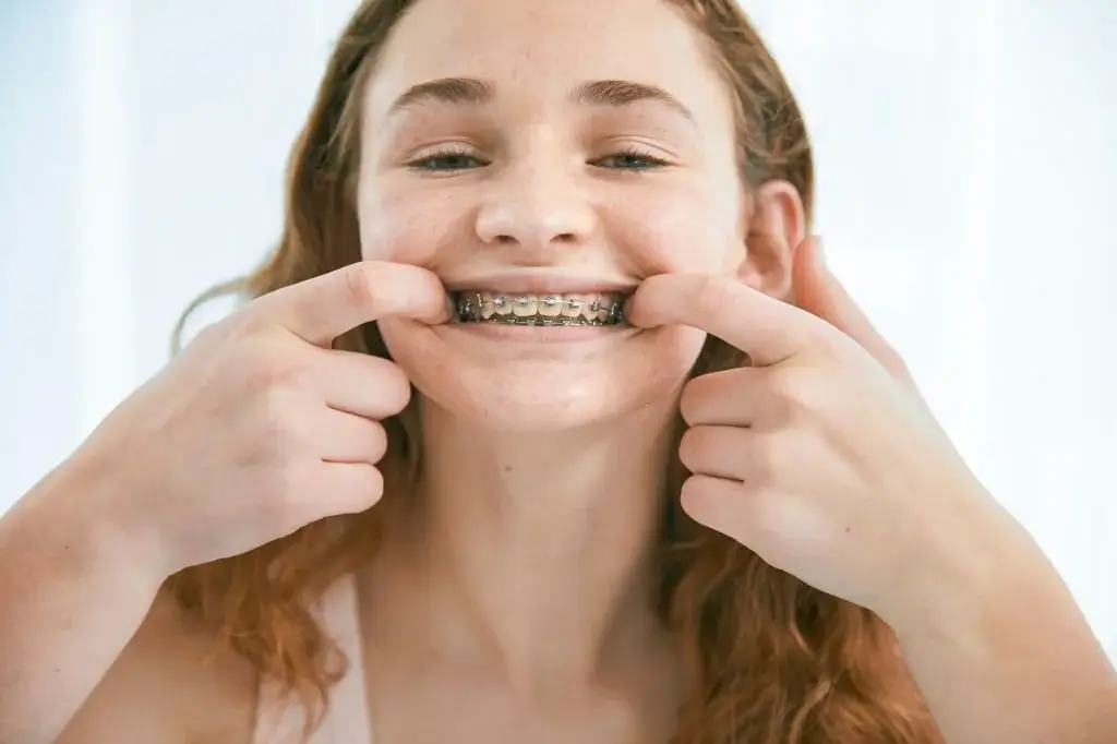 How To Get Rid Of White Spots On Toddler Teeth How To Get Rid Of White Spots On Toddler Teeth